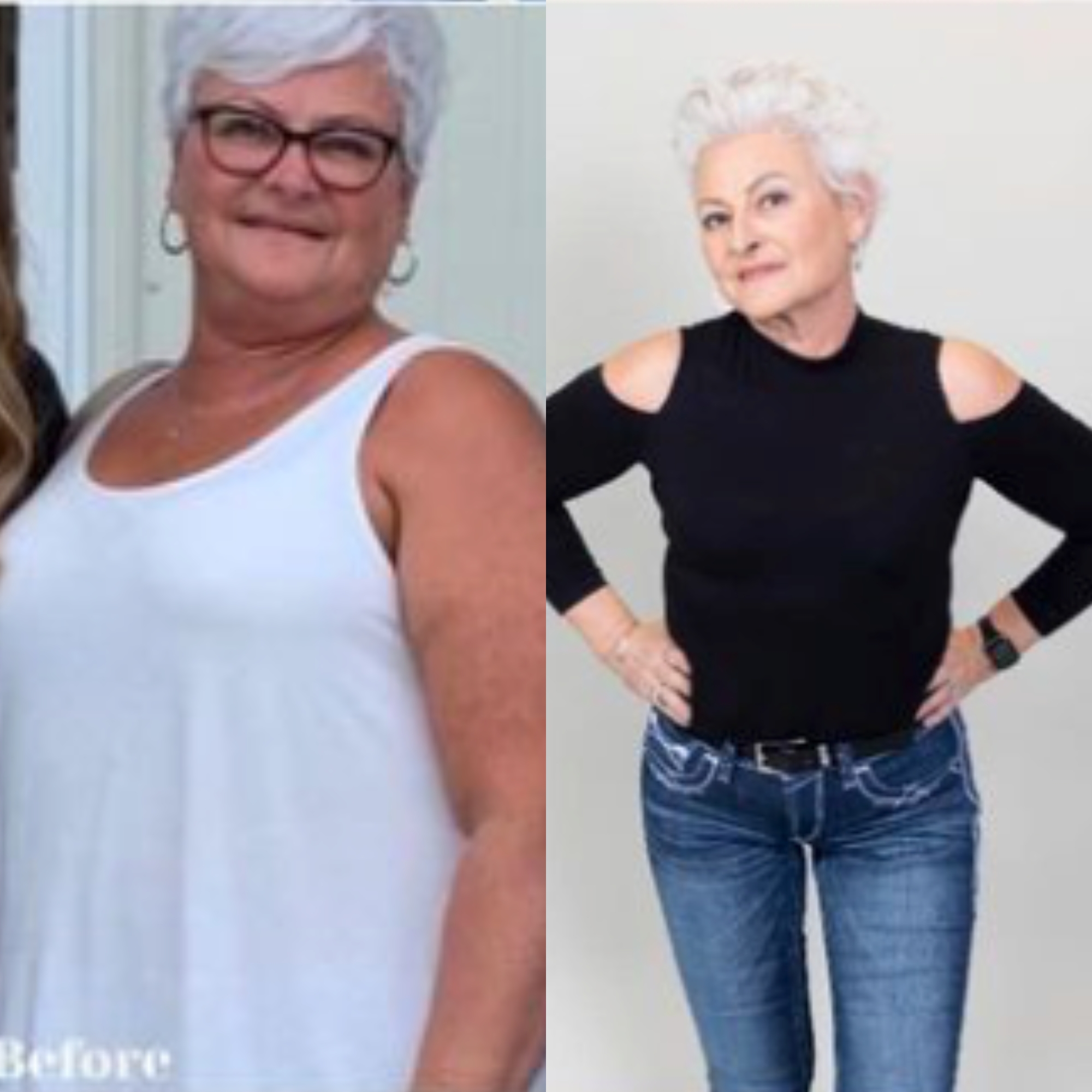 Matt Simpson, MD – Metabolic & Bariatric Surgeon – Springfield, MO